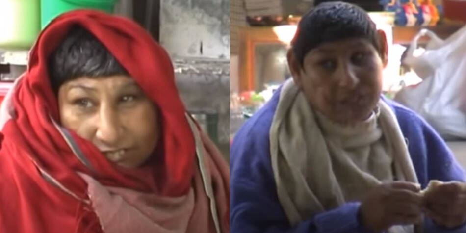 ‘Niños ratas’: Tradición pakistaní que malforma niños y los explota