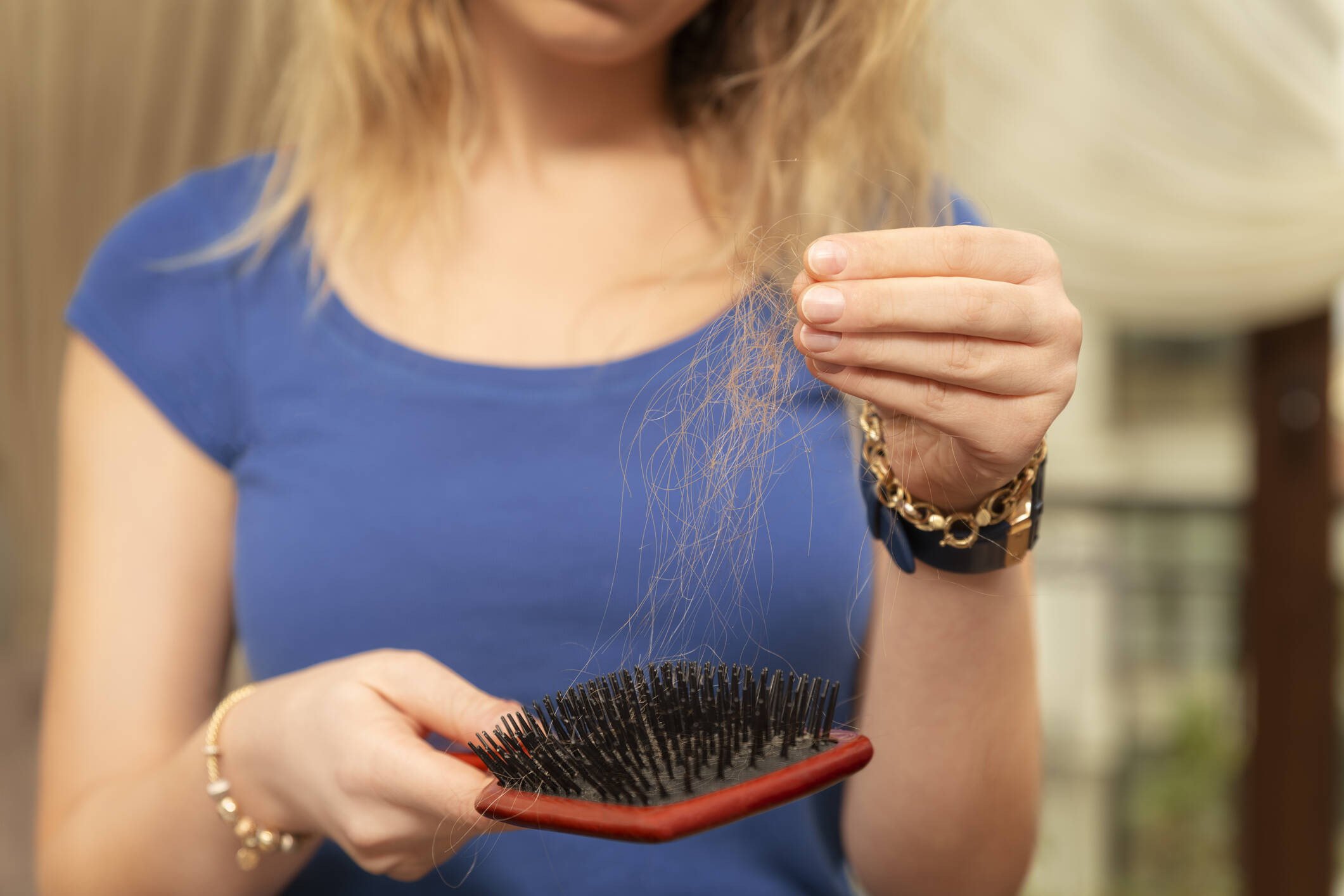 ¿Qué tiene que ver la tiroides con la caída del cabello?