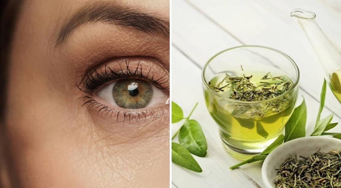 Remedios caseros para eliminar las ojeras: poderosas recetas con ...