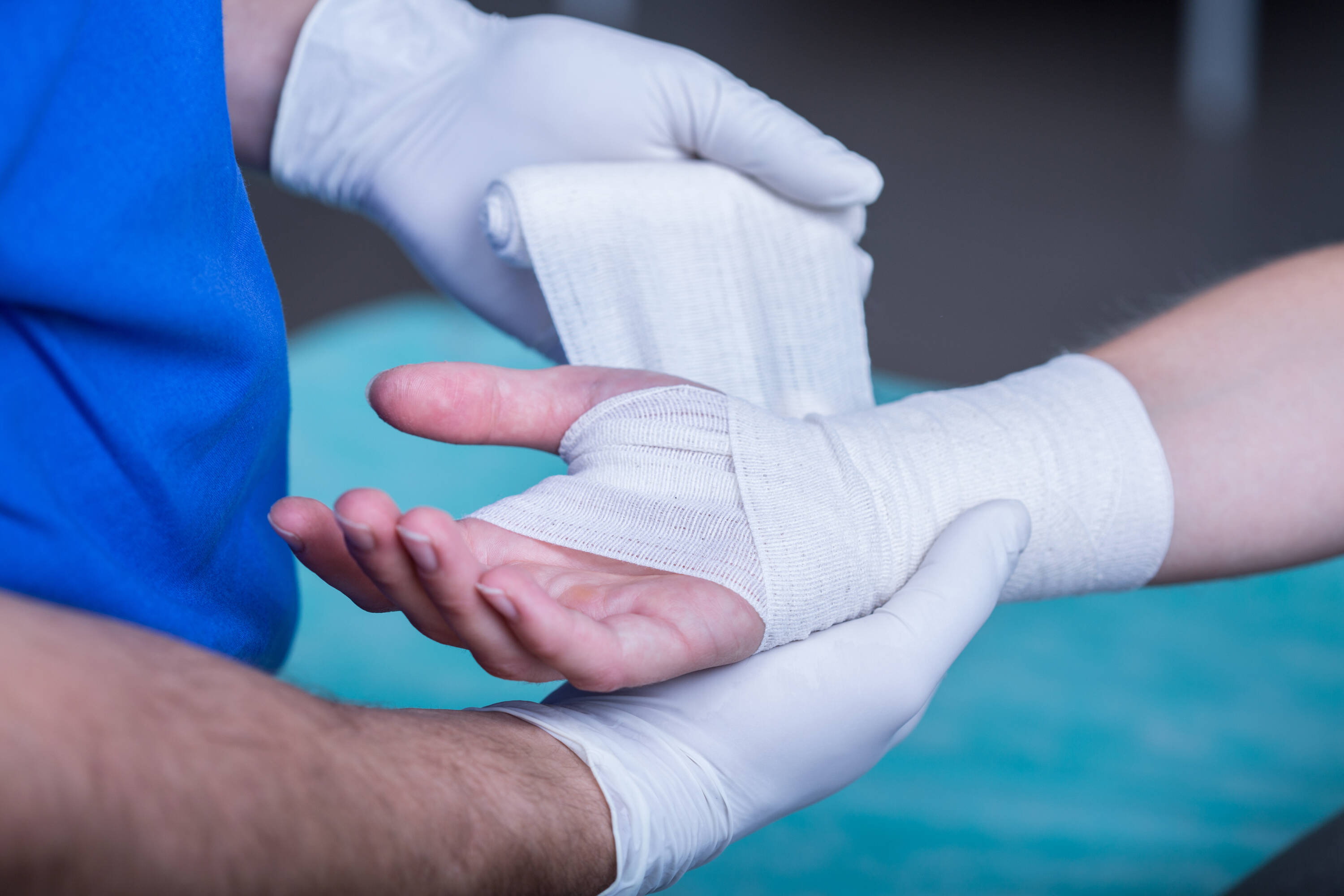¿Cómo saber si tiene una mano fracturada y cuál es su tratamiento?