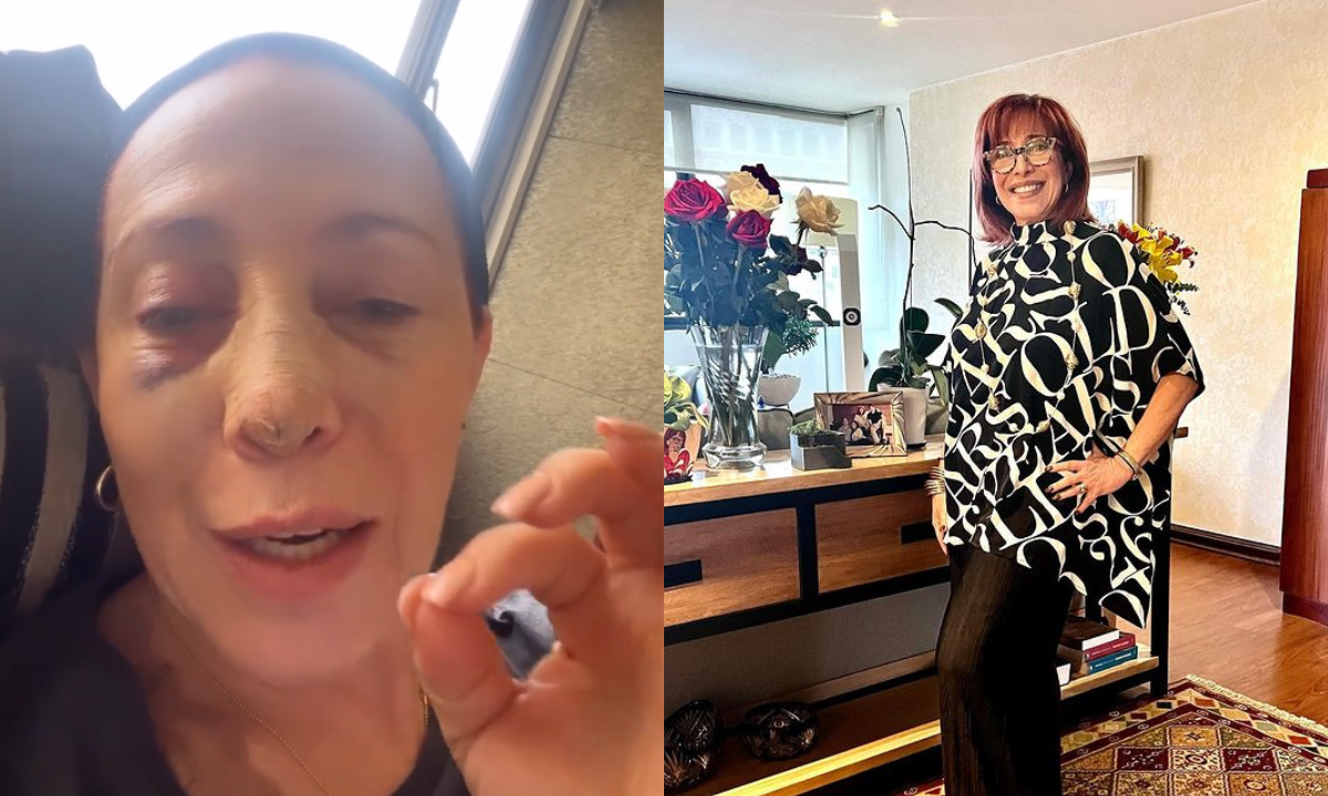 Yaneth Waldman sufrió un accidente en su rostro y tuvo que entrar a cirugía