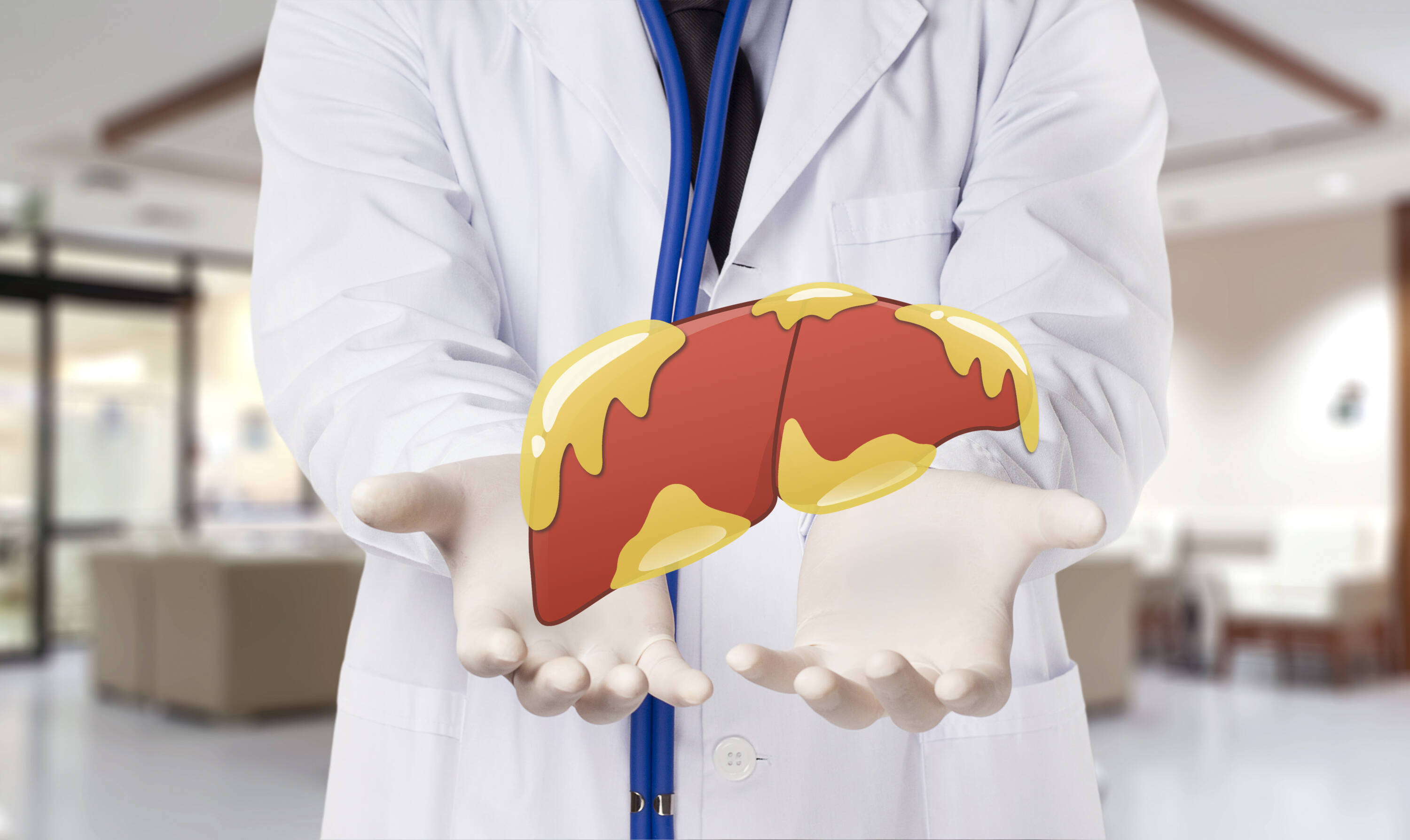 Gamma-glutamil transpeptidasa GGT alto: ¿cómo se realiza prueba y qué ...