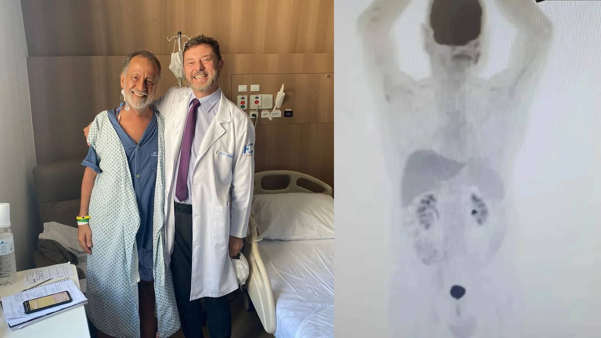 'Milagro de la ciencia': paciente con cáncer curó sus tumores con ...