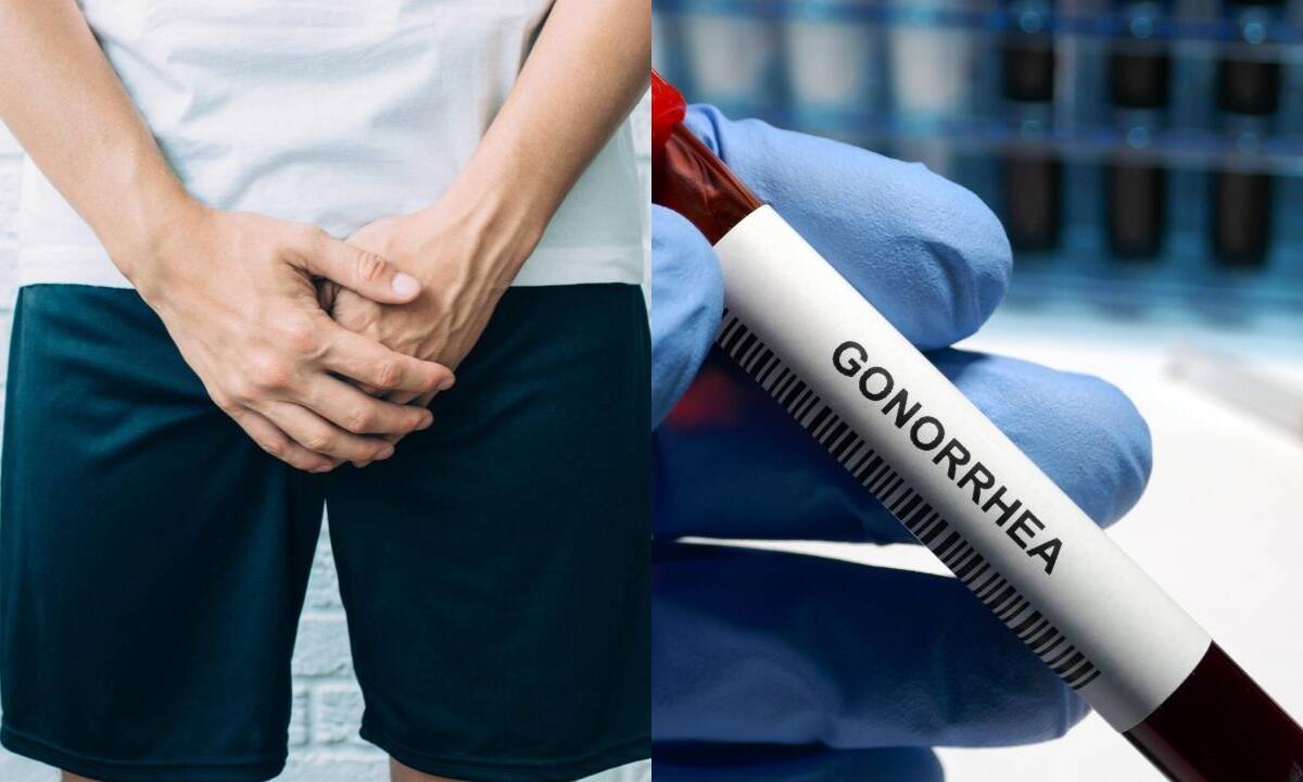 Gonorrea: estos son los síntomas de la enfermedad y sus posibles ...