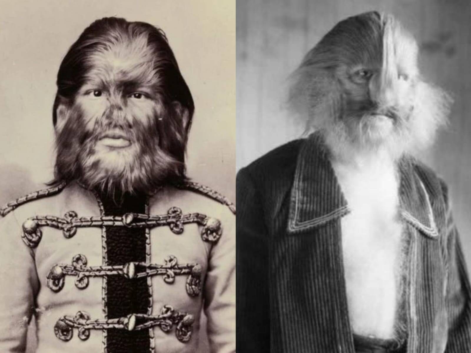 Stephan Bibrowski: el hombre con rostro de león que fue un fenómeno de ...