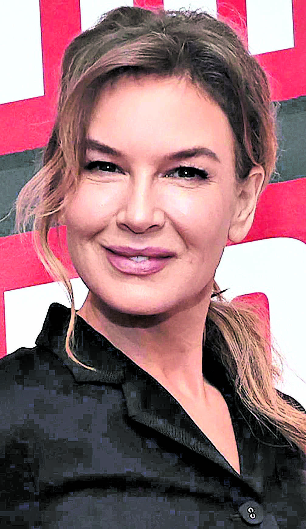 Pillow face: consecuencias y síntomas de aplicación de bótox y ácido ...