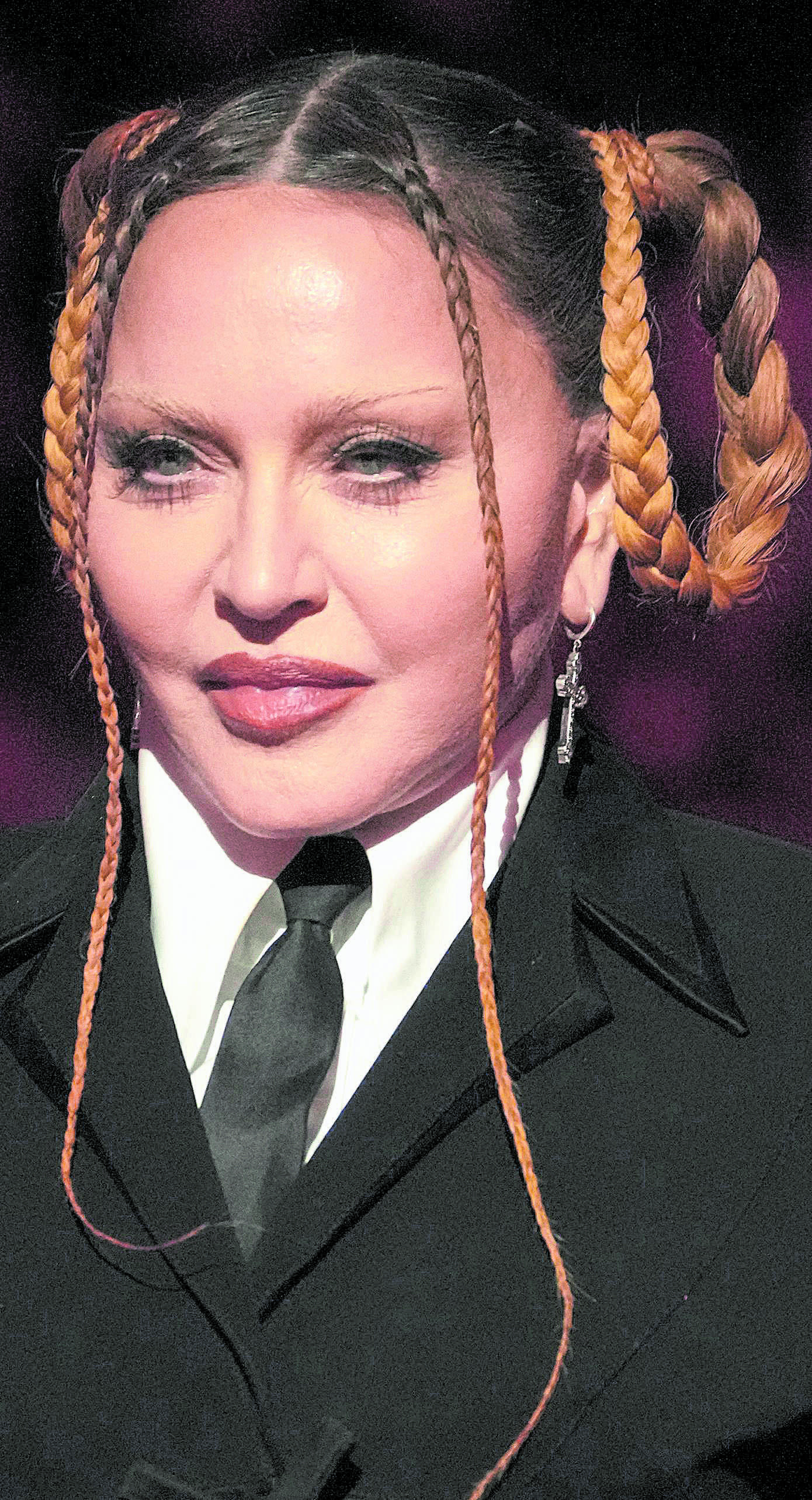 Pillow face: consecuencias y síntomas de aplicación de bótox y ácido ...