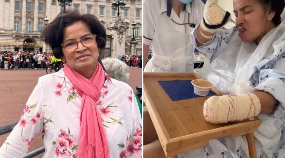 Colombiana a la que le amputaron sus manos por bacteria aprende a comer ...