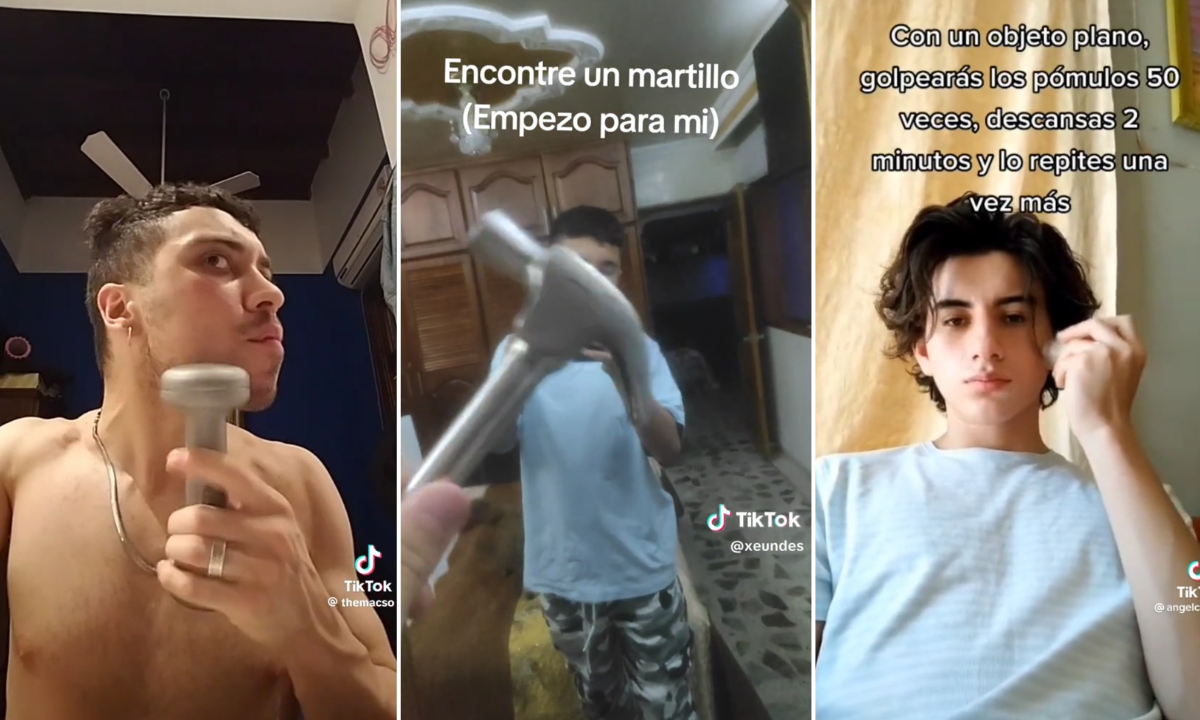'Bone smashing', el peligroso reto de TikTok de 'moldearse' la cara con ... 'Bone smashing', el peligroso reto de TikTok de 'moldearse' la cara con ...