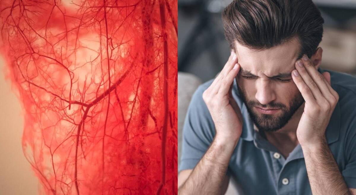 Vasculitis: ¿qué es, cómo se desarrolla y cuáles son sus sintomas?