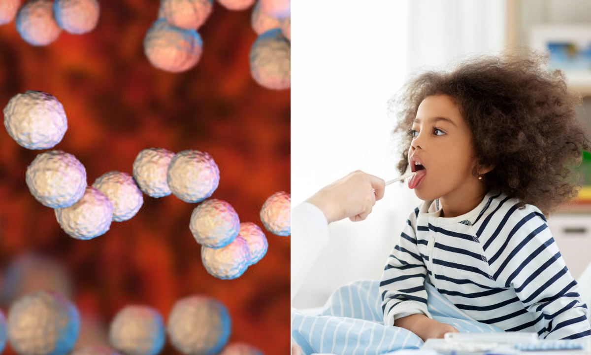 Preocupación en Argentina por bacteria Streptococcus pyogenes: van 64 ...