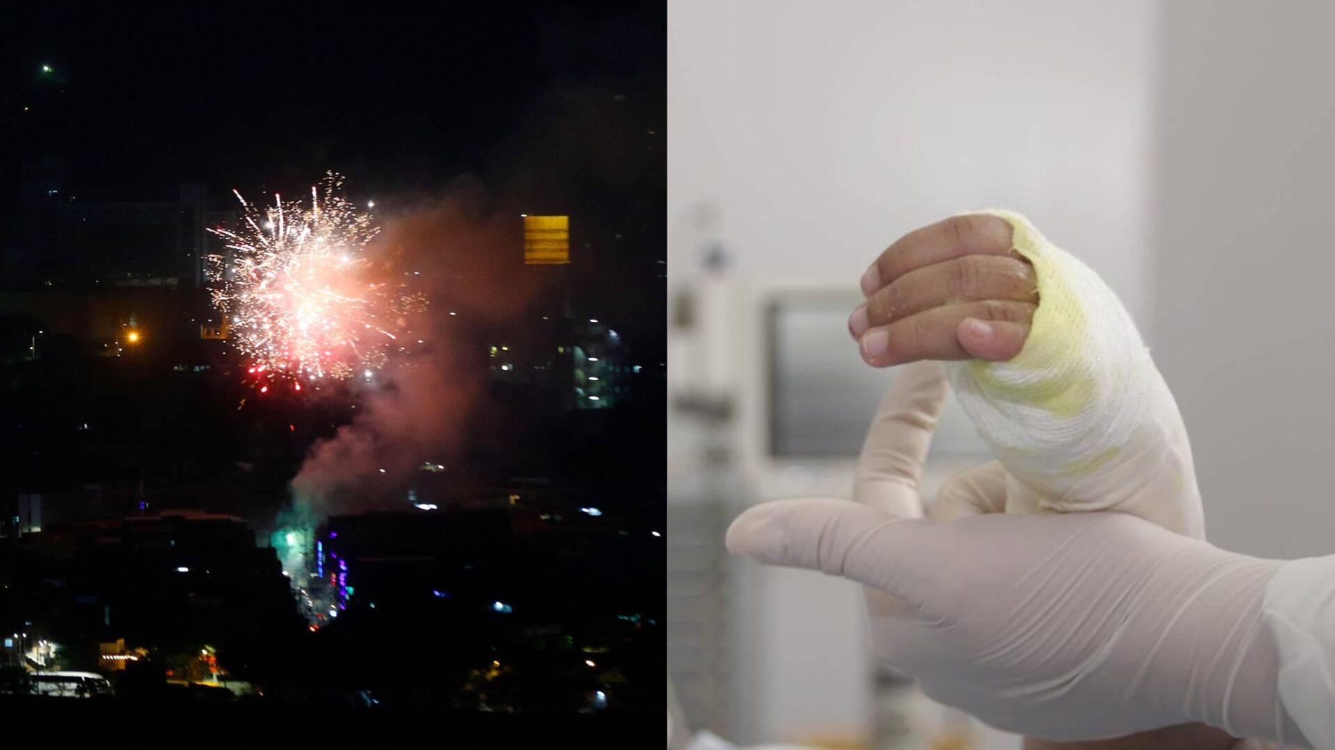 Dos bebés de 2 y 3 años sufrieron graves quemaduras, una en la mano y ...