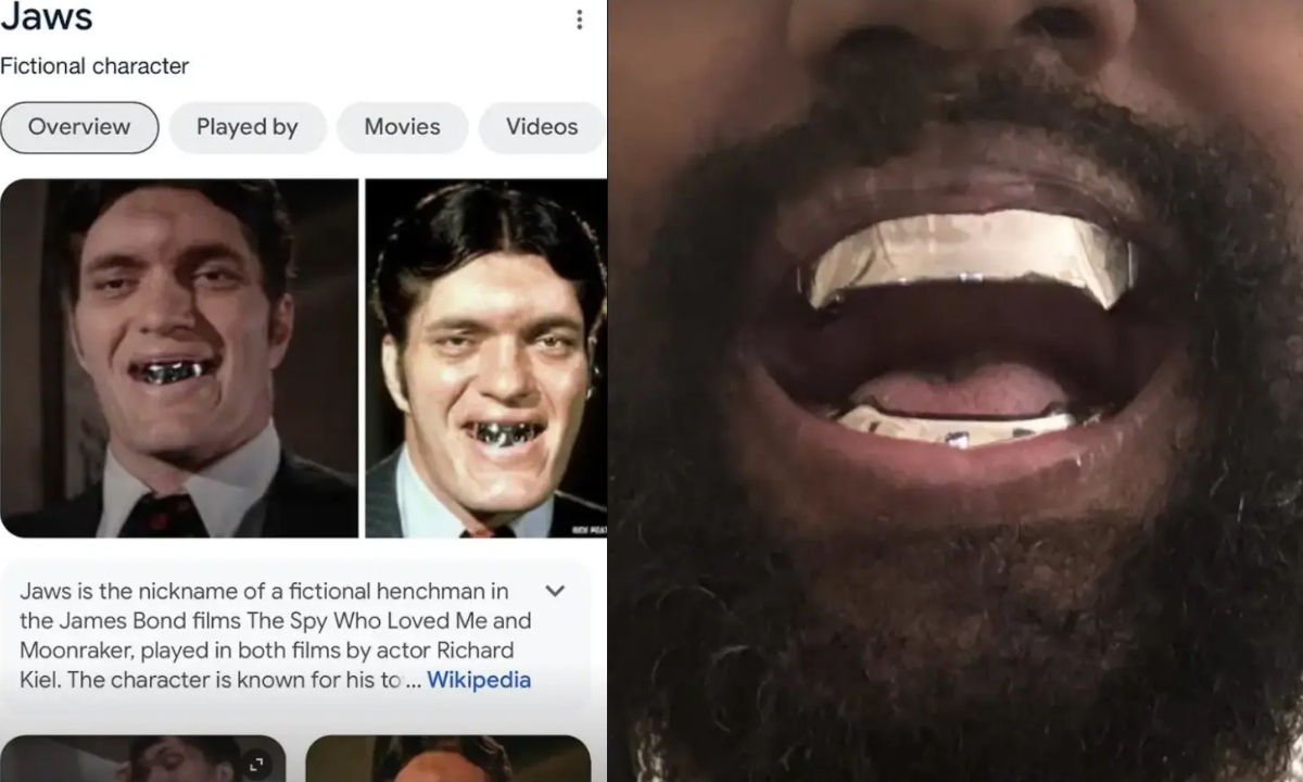 Kanye West se implanta dentadura de titanio inspirada en Tiburón ...