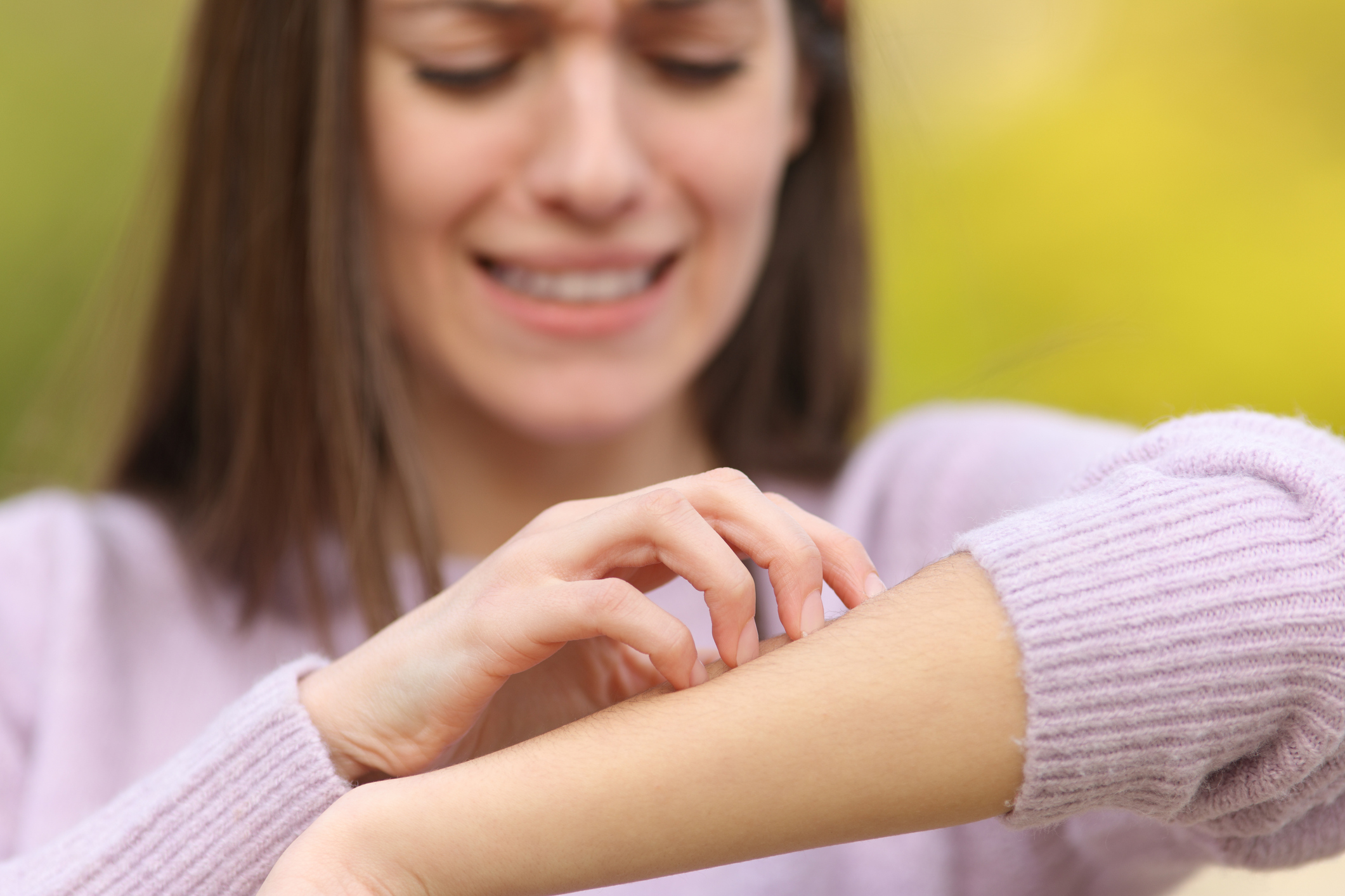 Dermatitis por sudor: causas, síntomas y prevención