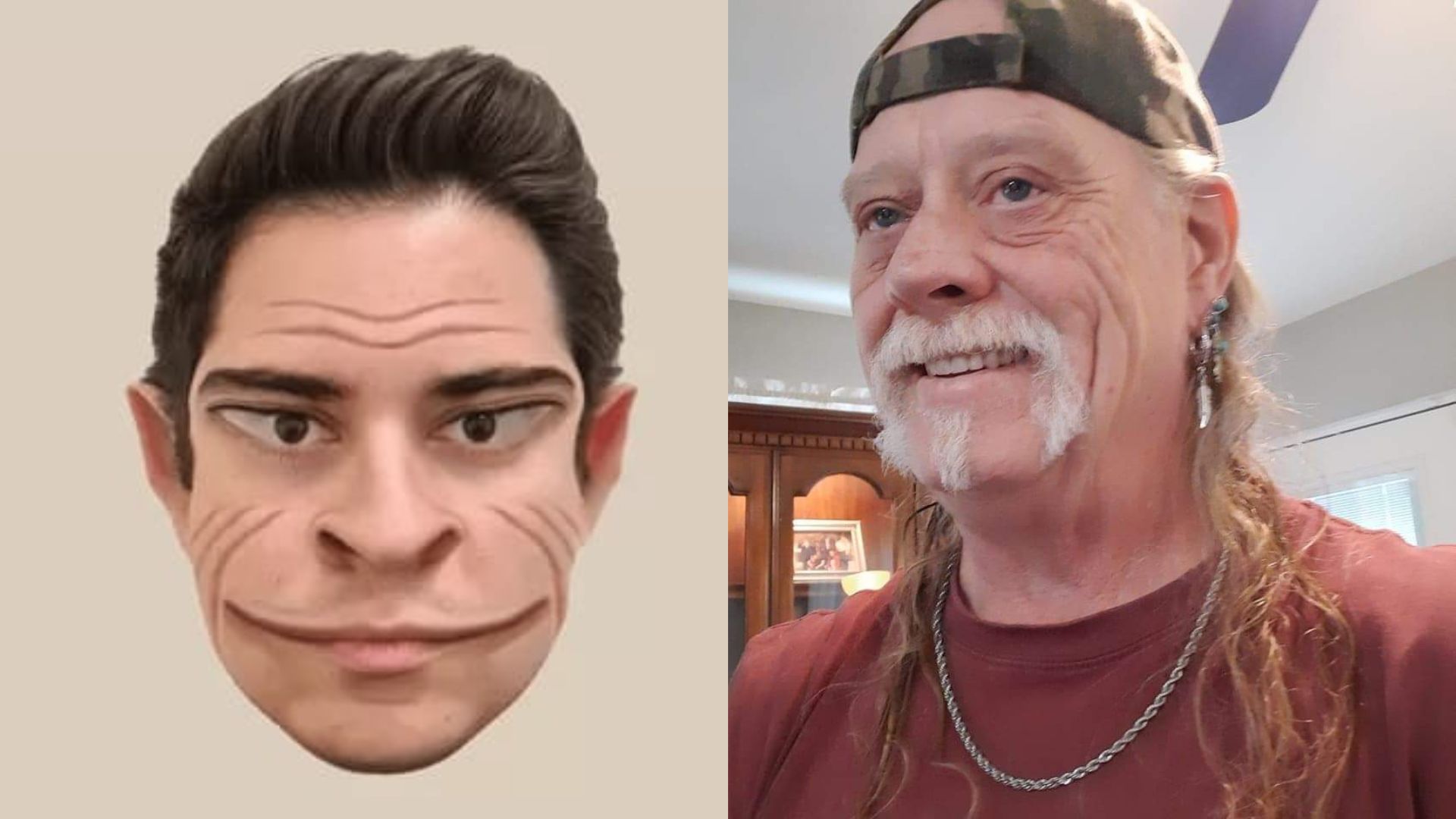 Este hombre es una de las 100 personas en el mundo con el 'síndrome de ...
