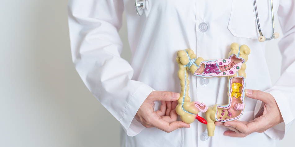 Seis síntomas silenciosos del cáncer de colon que no debe ignorar: esté ...