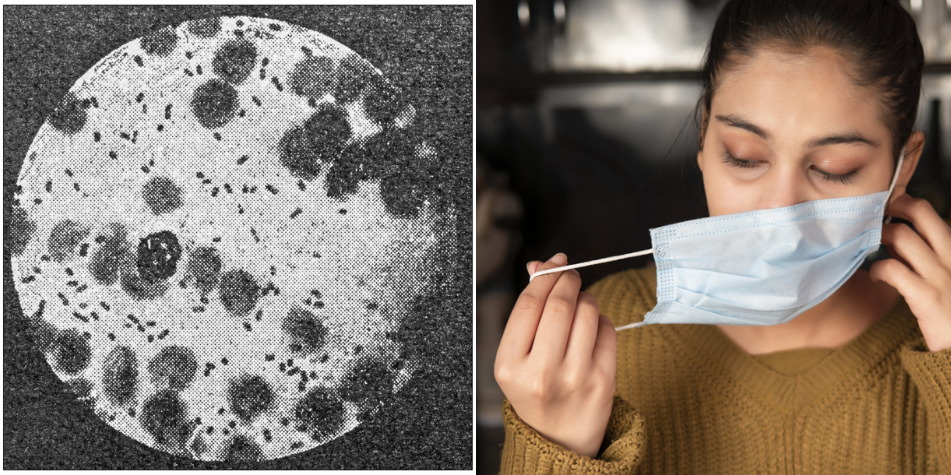 ¿Qué es la peste bubónica y qué síntomas da?