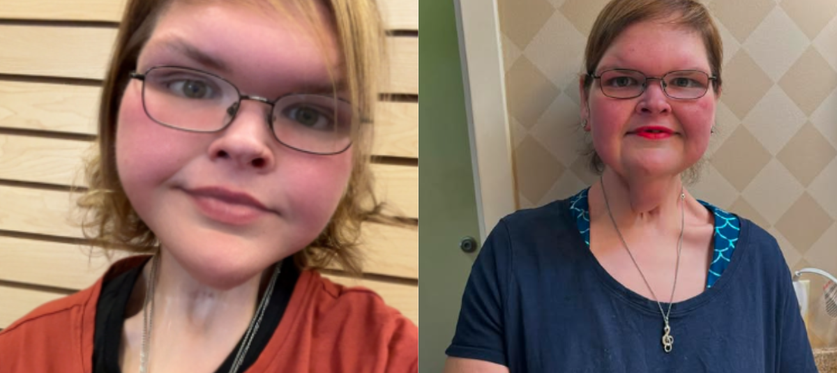 Amber Rachdi pesaba 300 kilos, intentó hacer dieta y ejercicio, pero no ...